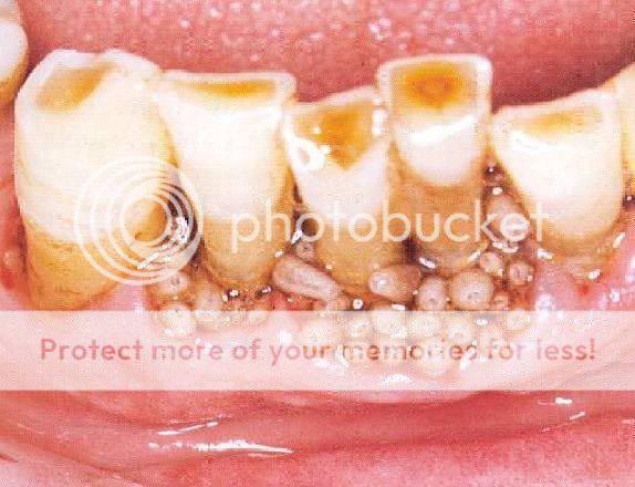 Teeth Maggots Photo by sadlands | Photobucket
